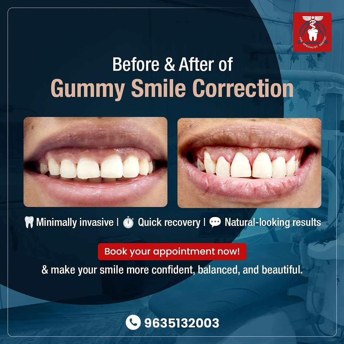 Periodontics: Your Complete Guide to Healthy Gums and Expert Treatment ...