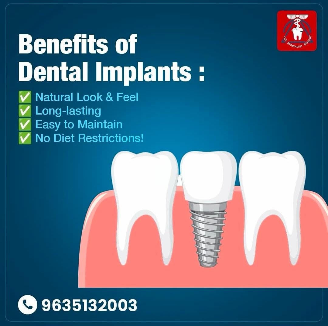 Dental Implants: Your Complete Guide to a Permanent Tooth Replacement ...